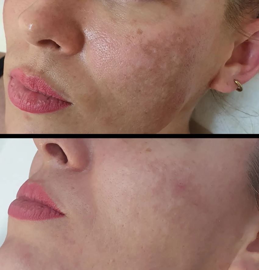Elegant Beautylab - Θεραπείες Ομορφιάς Μαρτίου Θεσσαλονίκη